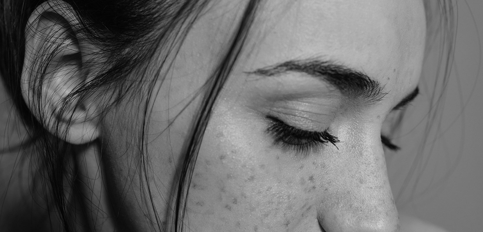 Brow Lift in Boston, MA | Boustany Plastic Surgery